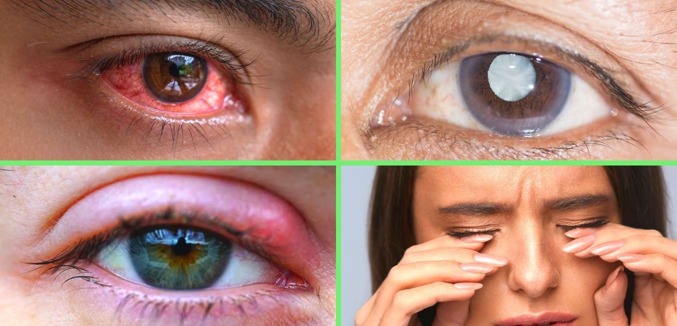 Eye Diseases and Conditions - Kesona Eye Centre
